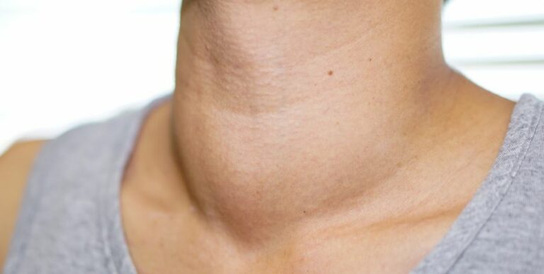 Swollen Neck or Lump: Thyroid Warning Sign & When to Check