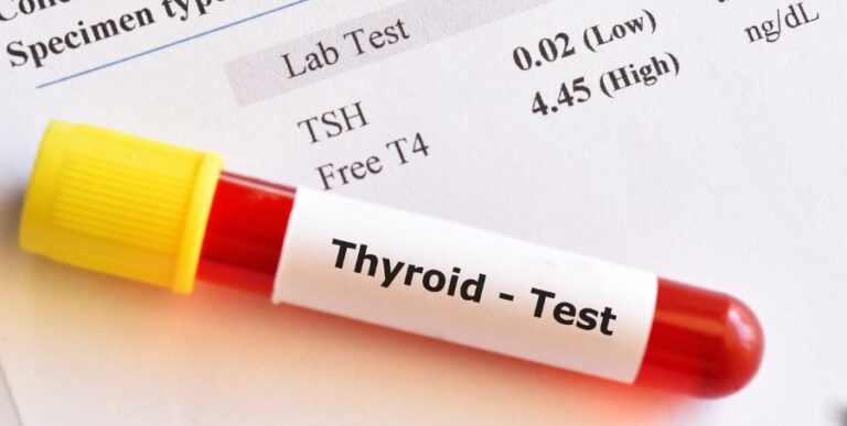 When to Worry About Thyroid Nodules - Centre for Screening and Surgery
